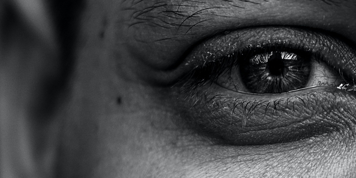 Understanding Dark Circles: Causes and Solutions for Tired-Looking Eyes ...